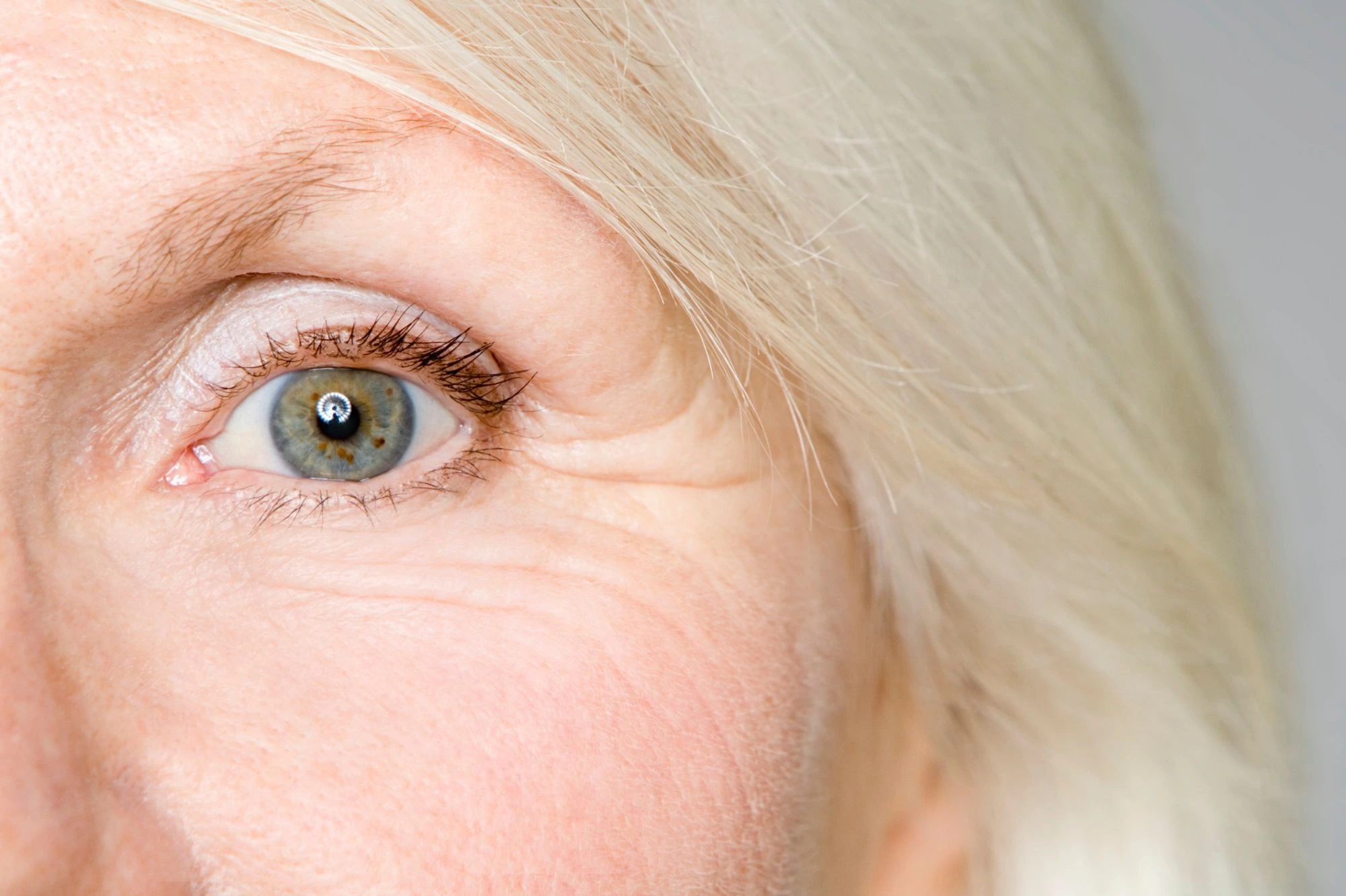 The 5 Most Common Age-Related Eye Diseases (And How to Keep Them ...